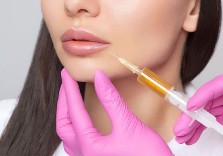 10 things you should know before dermal filler injection! – Aurafeel